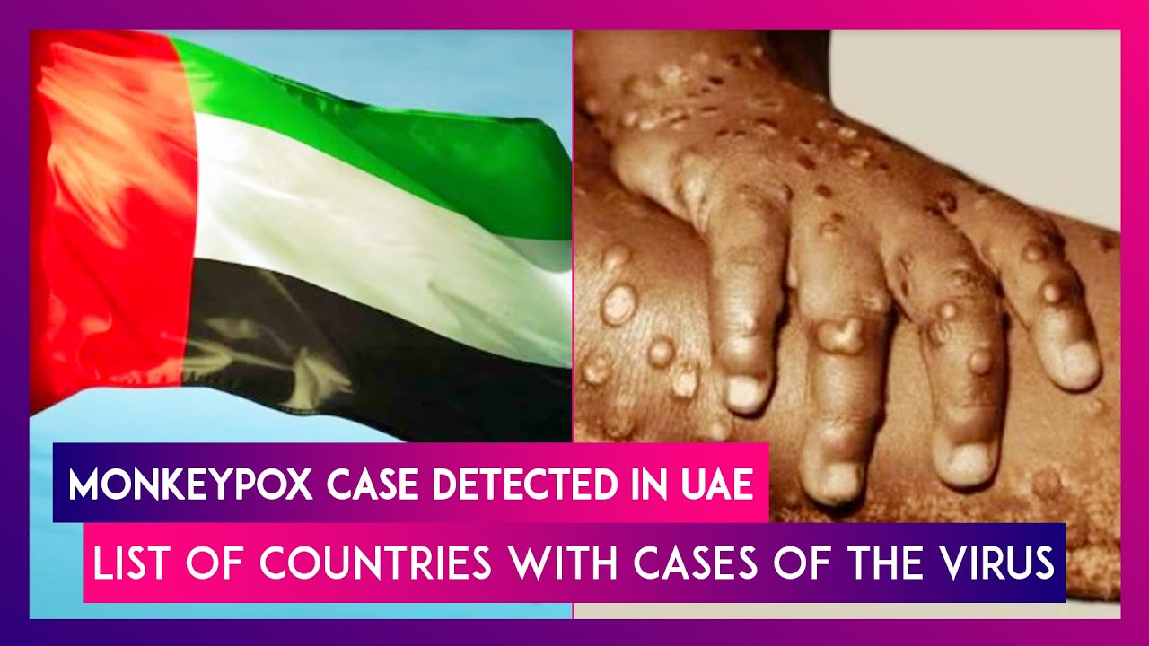 Monkeypox Case Detected In UAE, List Of Countries With Confirmed Cases ...