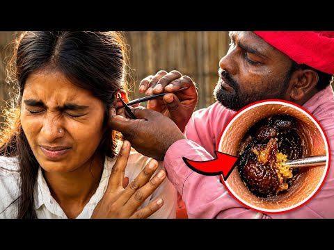 Indian Street Ear Wax Removal 😱 | The Most Satisfying Deep Ear Cleaning ASMR 