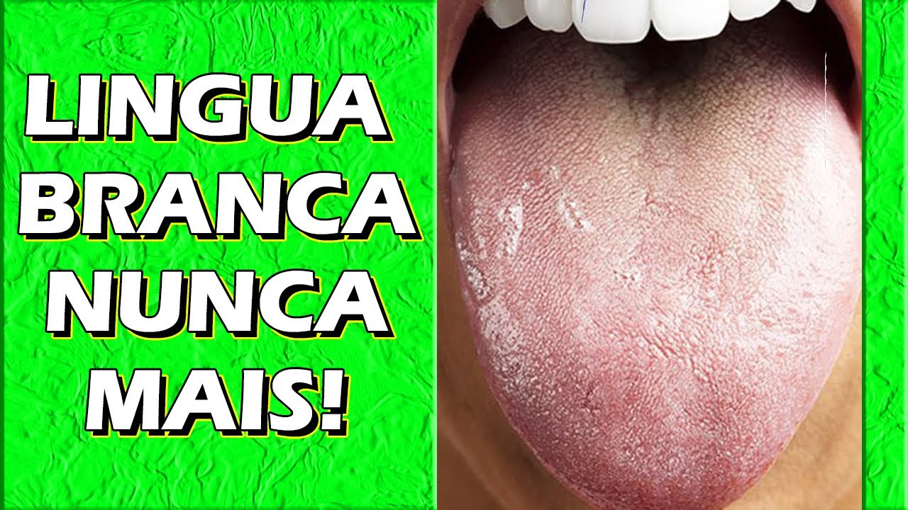 A MELHOR FORMA DE ACABAR COM A SABURRA LINGUAL! - YouTube