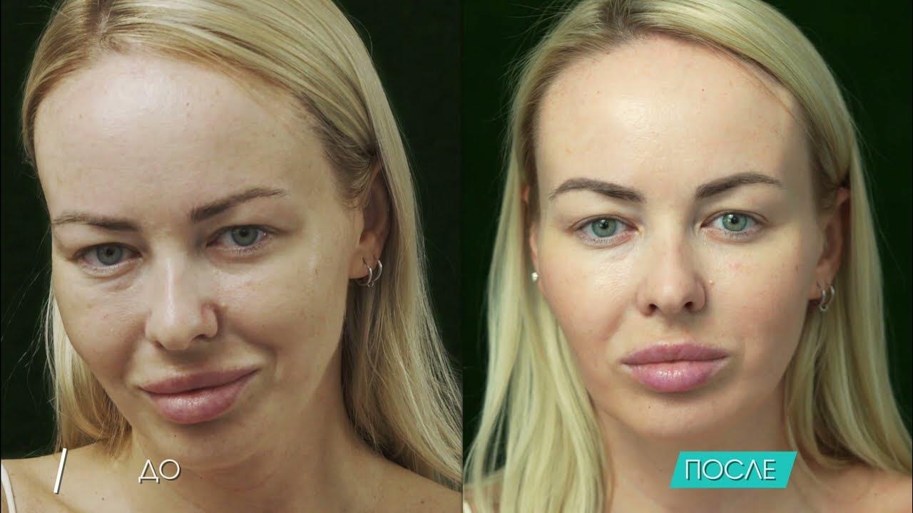 GYPSUM MASK ГИПСОВАЯ МАСКА ДЛЯ ПРОФЕССИОНАЛЬНОГО УХОДА - YouTube