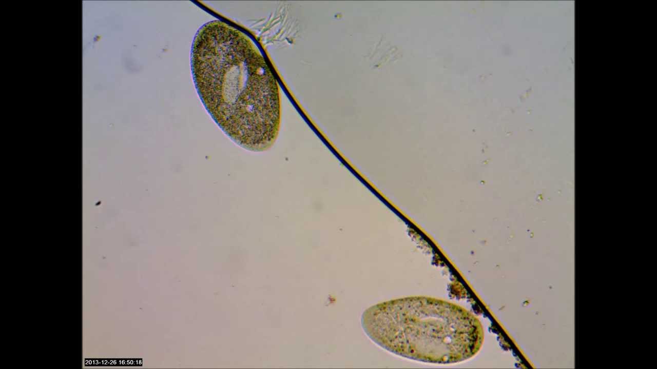 Cell Death - Catastrophic Rupture of a Cell Wall - YouTube