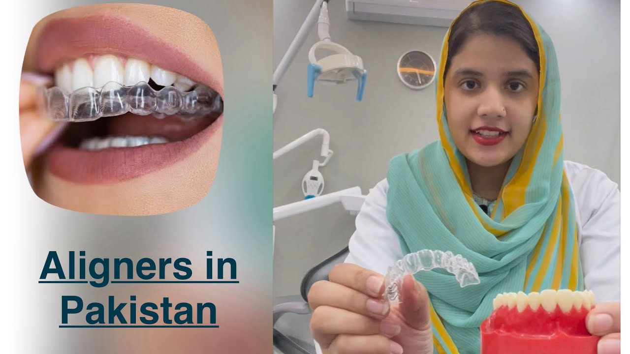 Aligners in Pakistan|Cost of Aligners| Complete guidance of Aligners| Where to get Aligners from ...