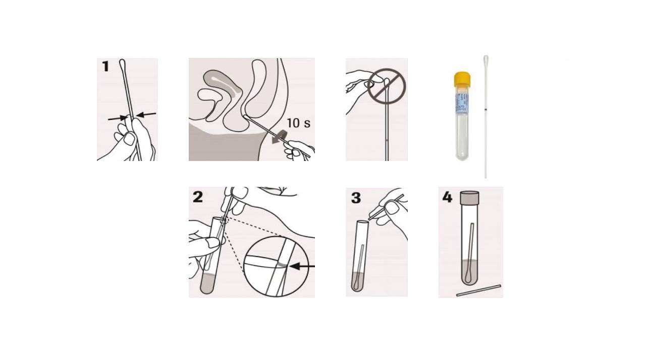 Hoe Gaat Een Soa-Test: Alles Wat Je Moet Weten