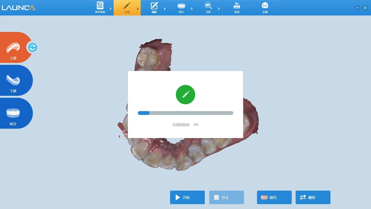 Launca Escaner Intraoral - DL-206 - Self Scan-29 segundos - YouTube