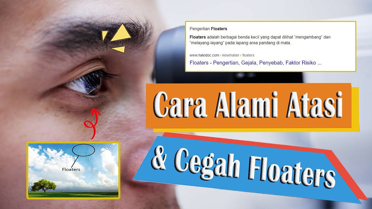 Jangan Panik ! Ketahui Inilah Cara Alami Atasi Floaters Sekaligus ...