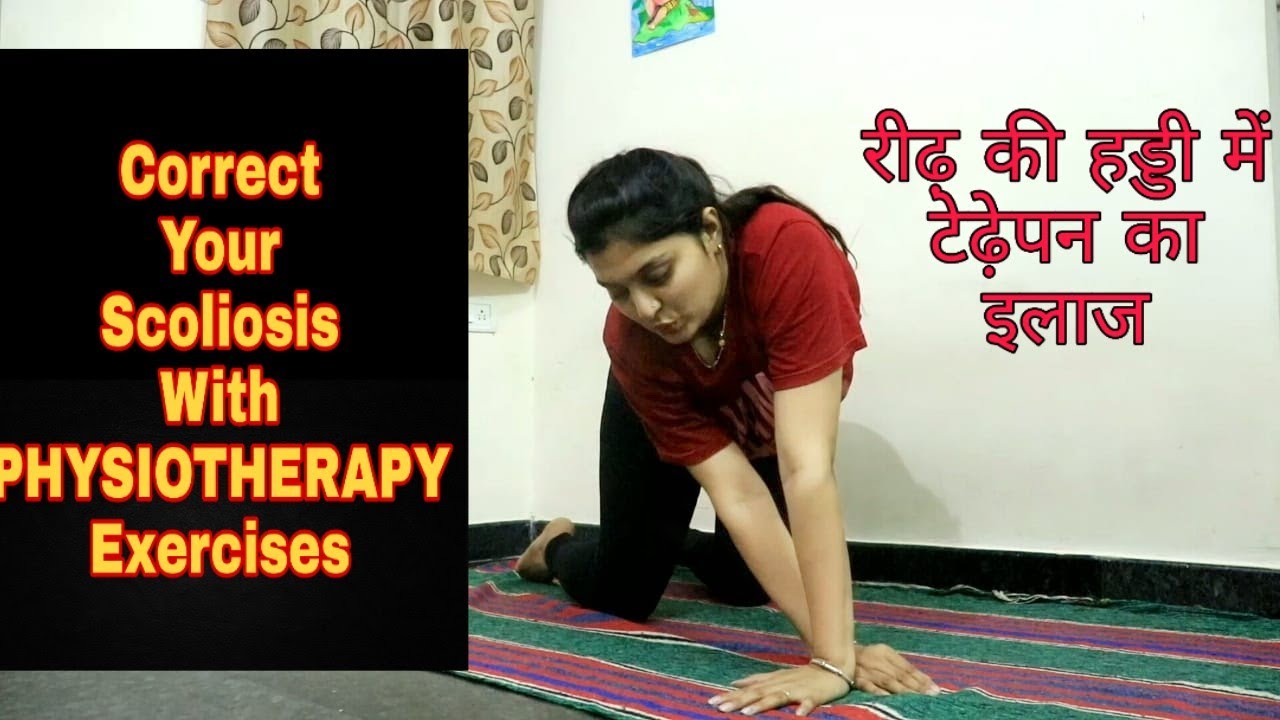 Physiotherapy Exercise for SCOLIOSIS | How to correct SCOLIOSIS ...