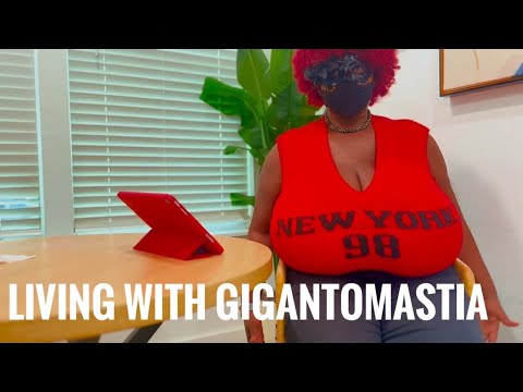 Living with Gigantomastia #macromastia#bodypositivity 