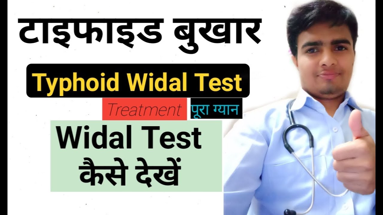 Typhoid Treatment / Widal Test / Typhoid Fever Symptoms,Causes ...