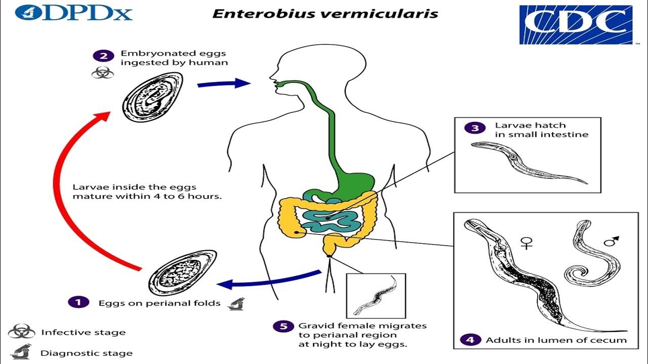 lec 3 2025, Enterobius vermicularis & Ascaris lumbricoids - YouTube