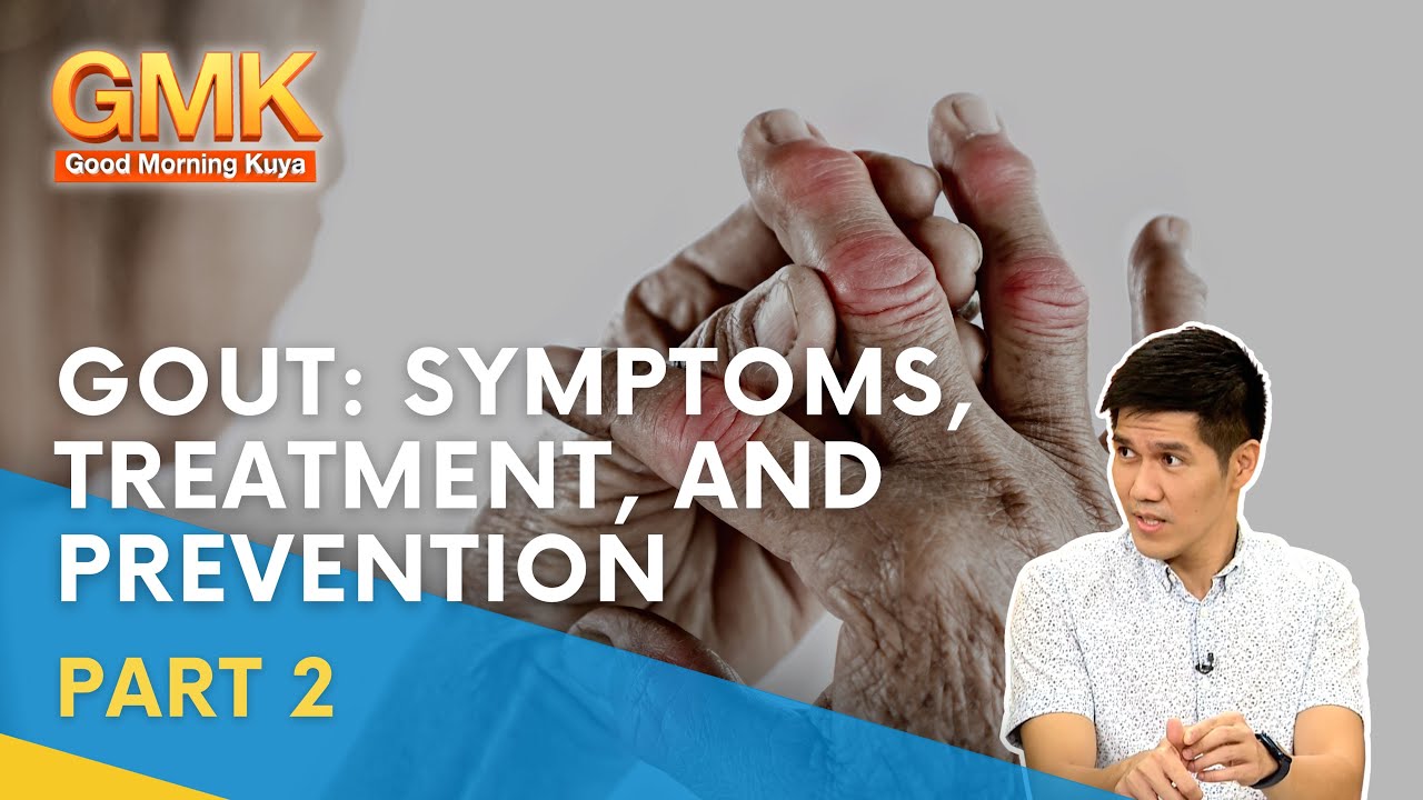 Gout: Symptoms, Treatment, and Prevention (Part 2) | Usapang ...