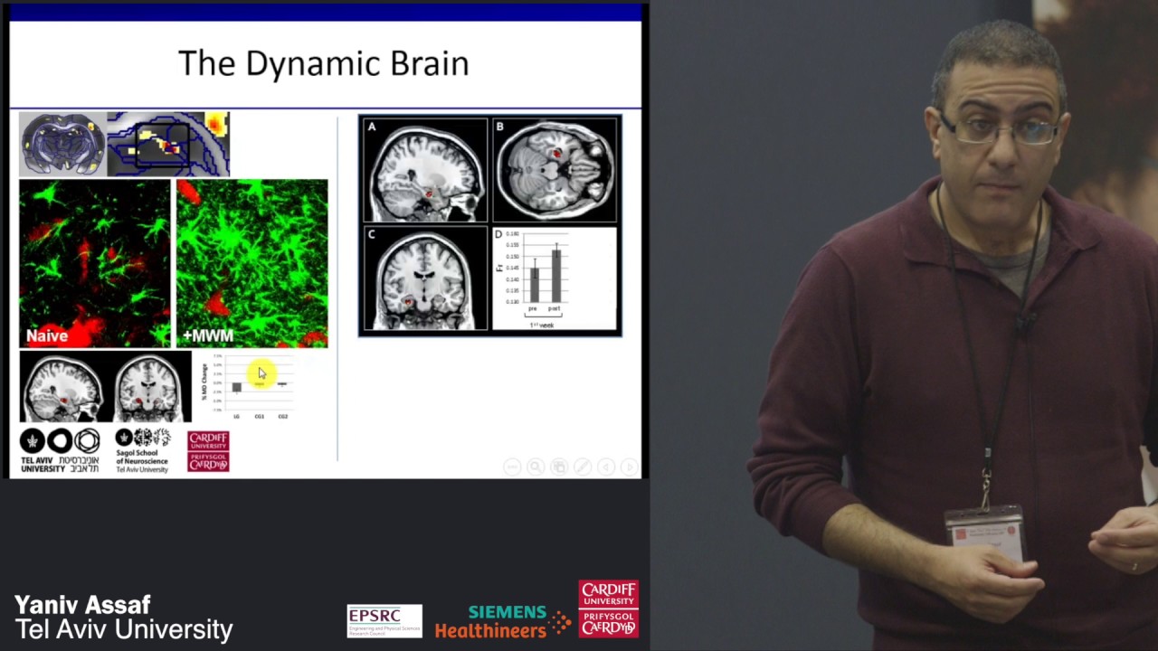 Diffusion beyond the tensor and it's applications - Yaniv Assaf - YouTube