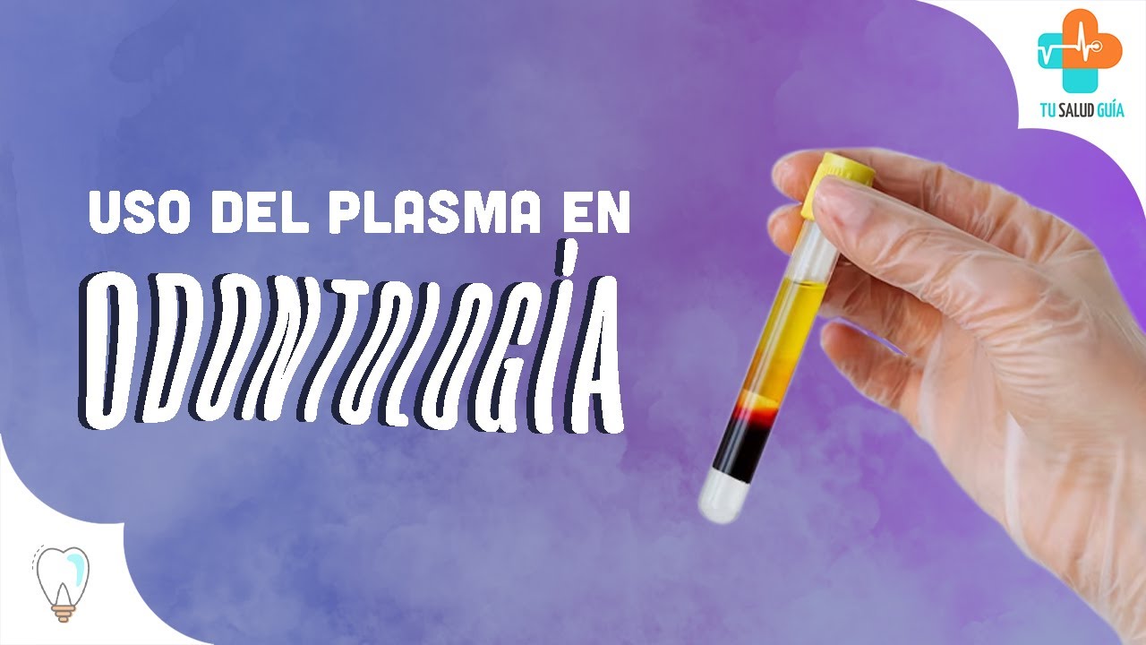 Uso del plasma en Odontología | Tu Salud Guía - YouTube