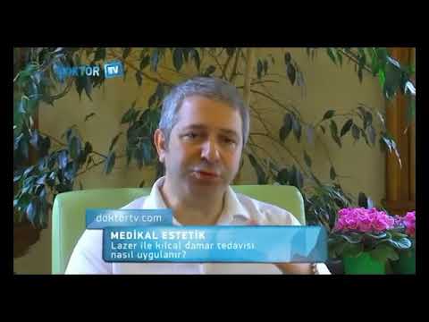 Lazerle Kılcal Damar Tedavisi Nasil Uygulanır