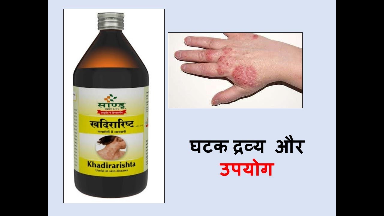 Khadirarishta l Khadirarishta ke fayde l Benefits of Khadirarishta ...