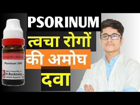Psorinum 1M | Psorinum 200 Homoeopathic Medicine uses in Hindi - YouTube