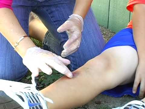 How to Use a First Aid Kit - First Aid Certification Courses Toronto - GTA | Ottawa | Barrie Ontario