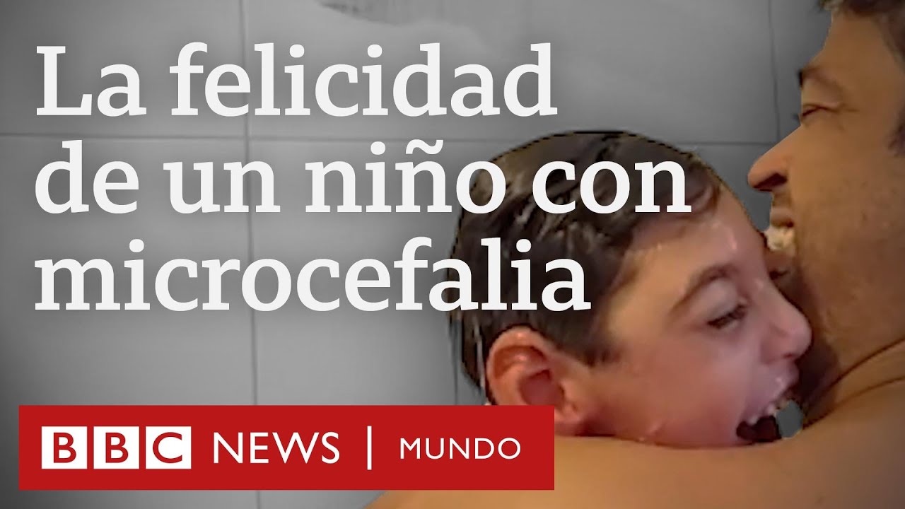 Microcefalia: la inesperada y feliz vida de una familia cinco años ...