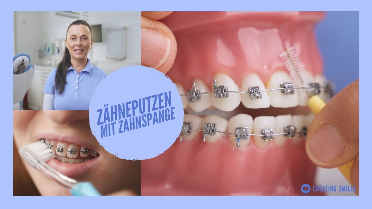 Zähneputzen mit Brackets - Unsere Tipps um die Zahnspange richtig ...