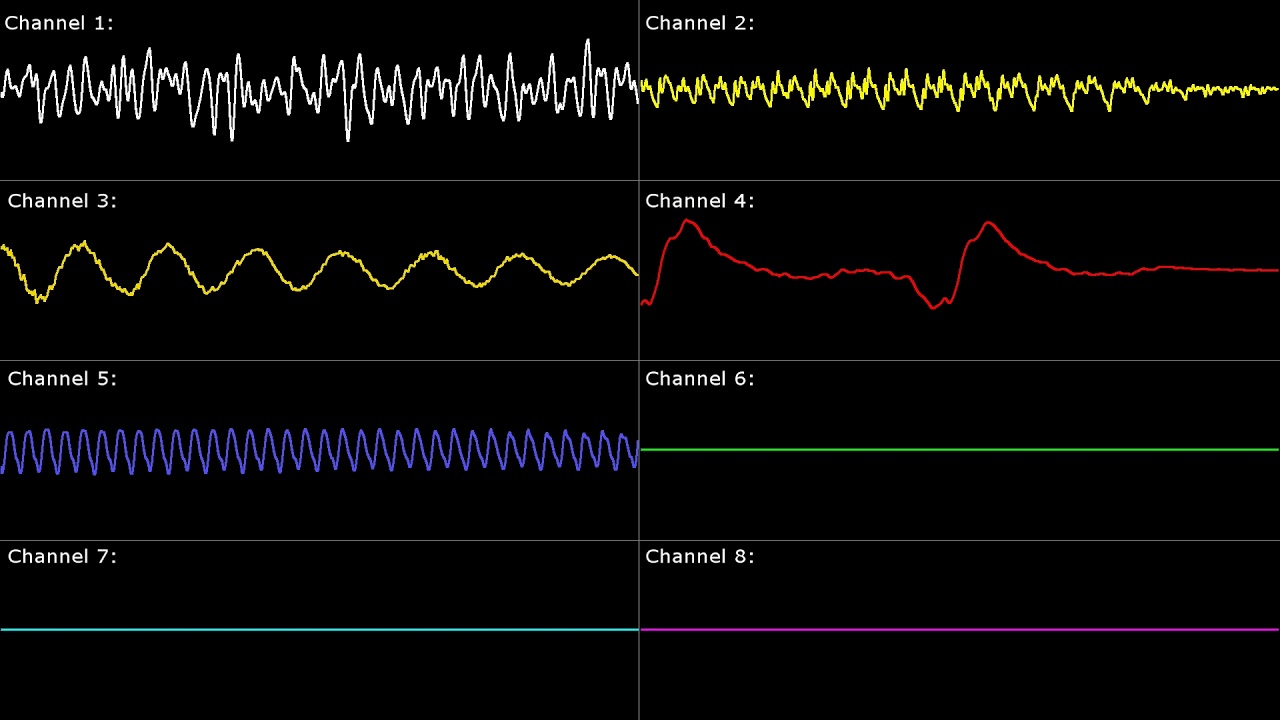 [SNES] Star Fox: Slot Machine - Oscilloscope View - YouTube