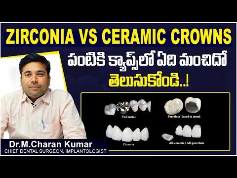 పంటికి క్యాప్ లో రకాలు || Types of Dental Crowns || Zirconia vs Ceramic || Eledent Dental Hospitals
