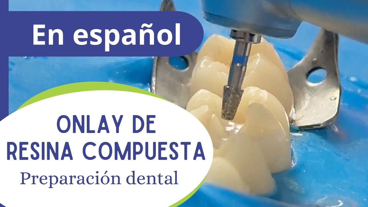 Onlay de resina compuesta - parte 1: preparación dental. - YouTube