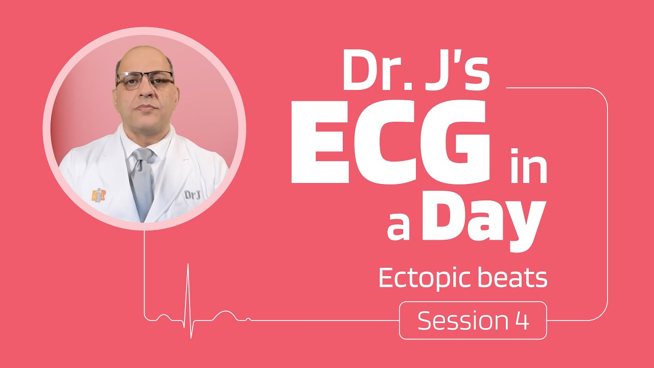 Master ECG in ONE DAY! - Ectopic Beats - YouTube