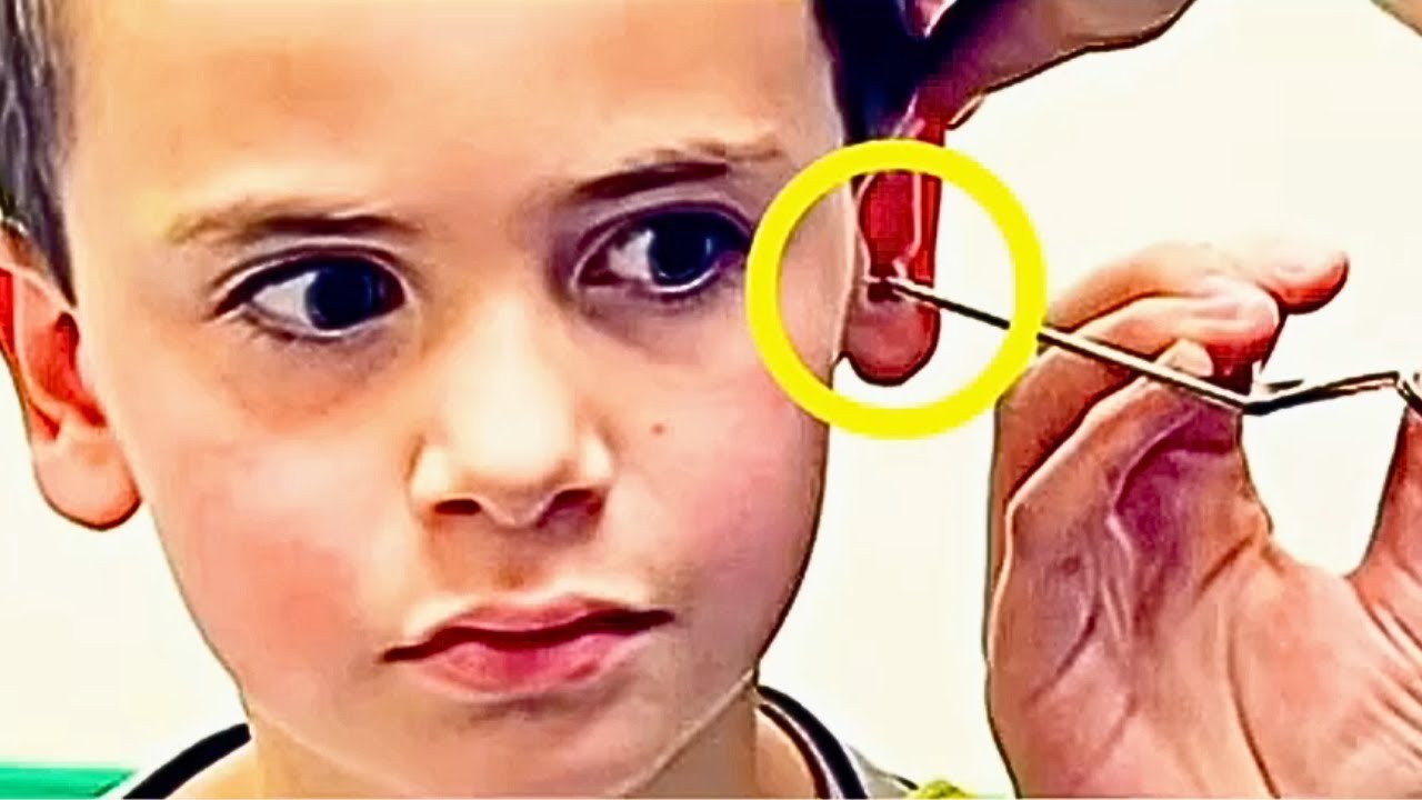 A child claims to have a pencil stuck in his ear! | heartwarming ...