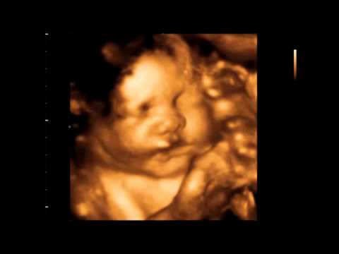3D/4D Ultrasound (31 weeks of my baby) - YouTube