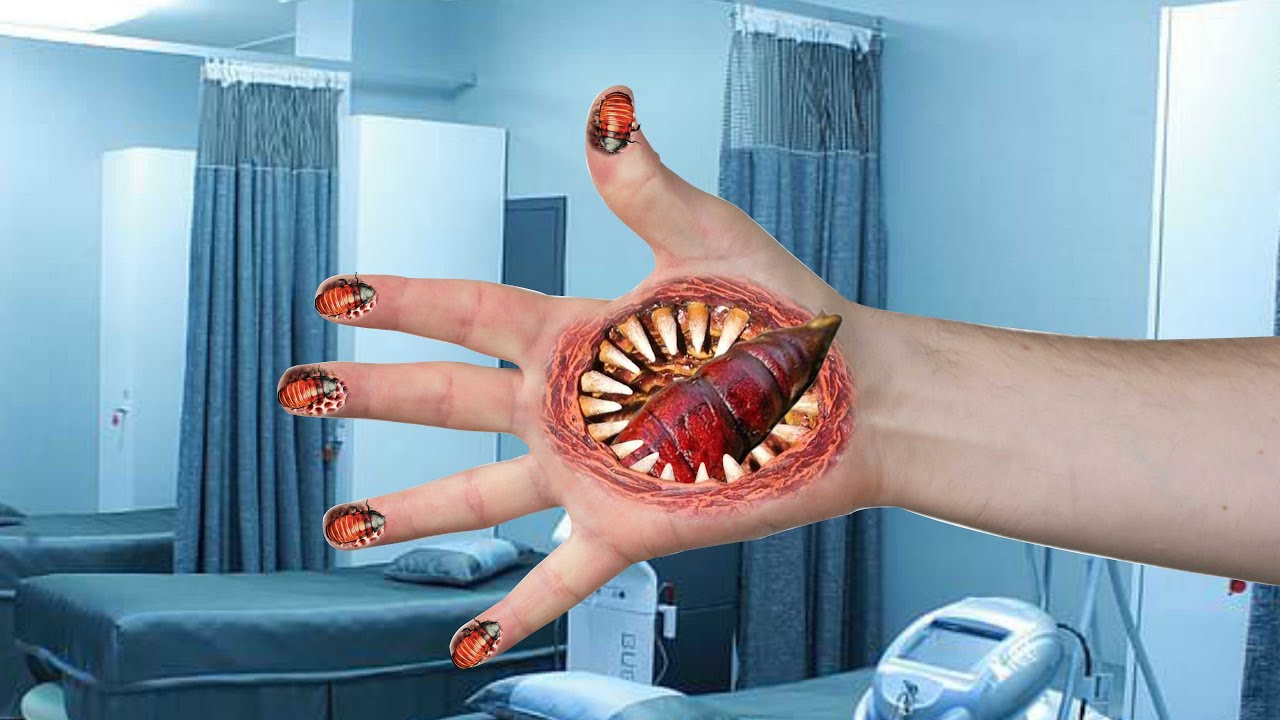 2d ASMR Animation Treatment on Hand worm and maggots removal ASMR ...