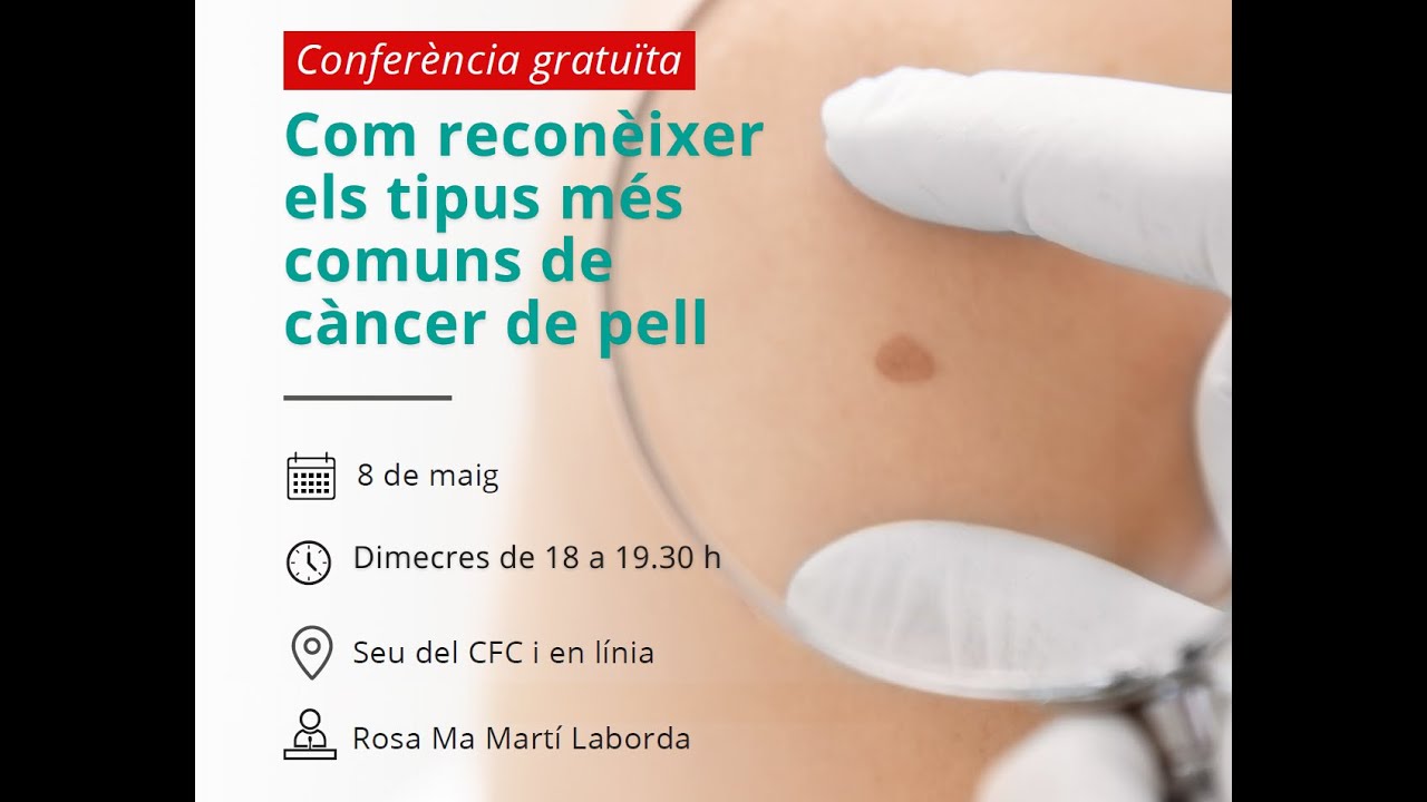 Com reconèixer els tipus més comuns de càncer de pell - YouTube