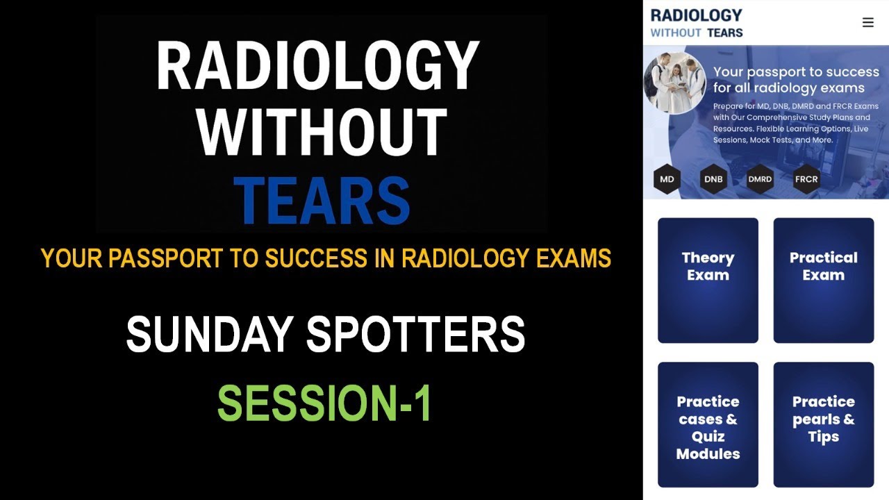 Radiology Sunday Spotters Session 1 - Radiology without Tears - YouTube