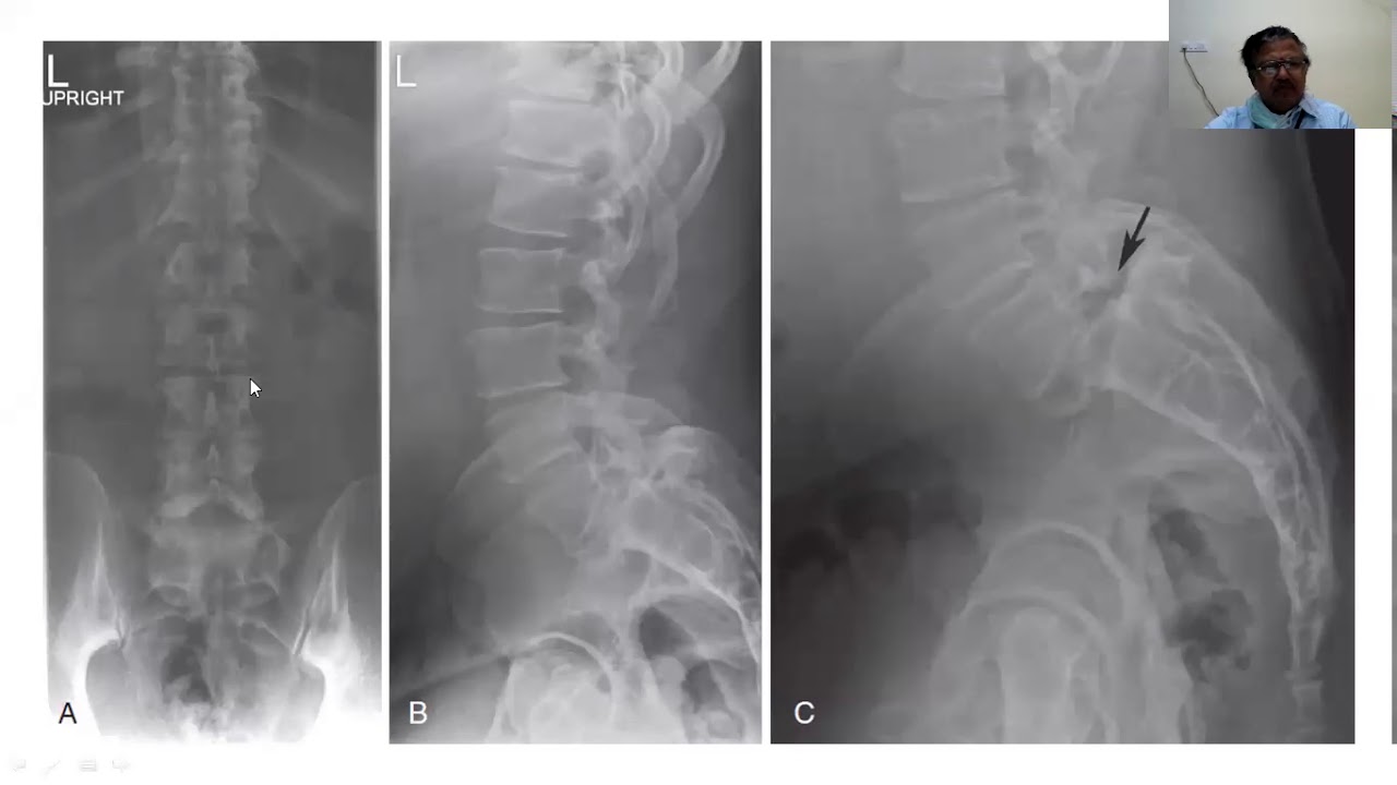 Dr P V Rao - YouTube