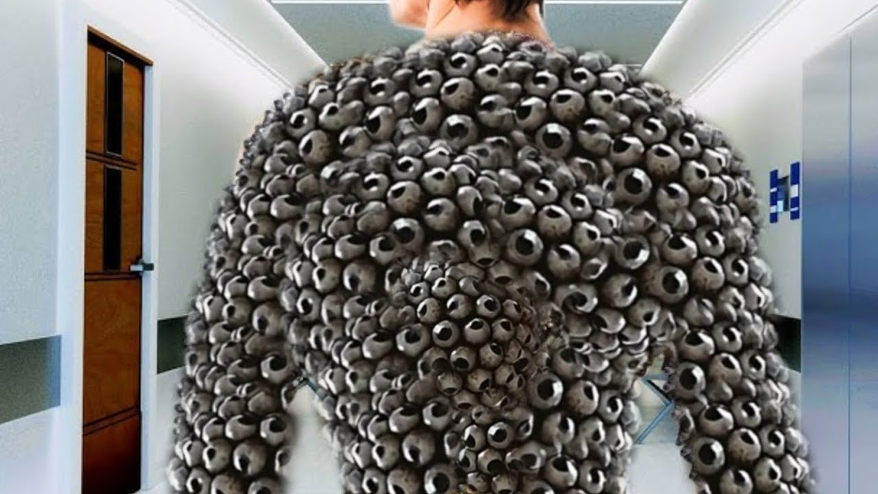 ASMR Dog Ticks Remove and Trypophobia | ASMR 2D Animation Treatment ...