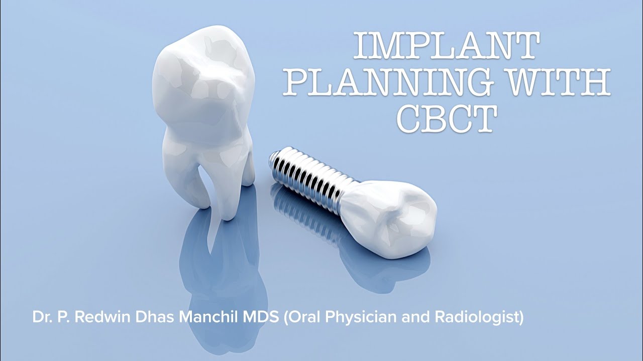 Implant Planning with CBCT - YouTube