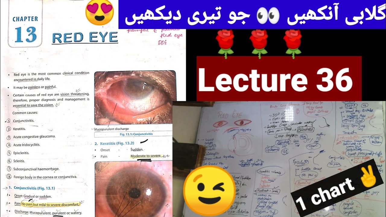 🔴 Clinical ophthalmology lectures #36 Red eye 👁‍🗨. causes of red Eye. # ...