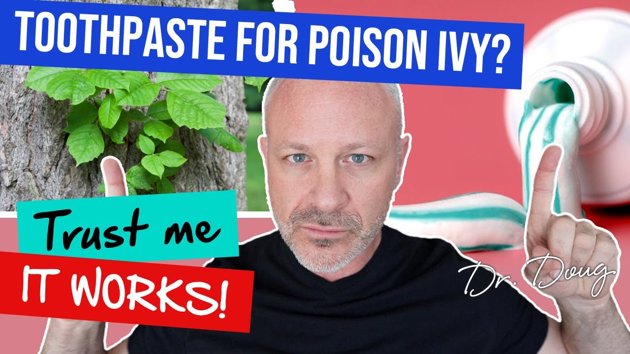 Poison Ivy Cure: TOOTHPASTE! - YouTube