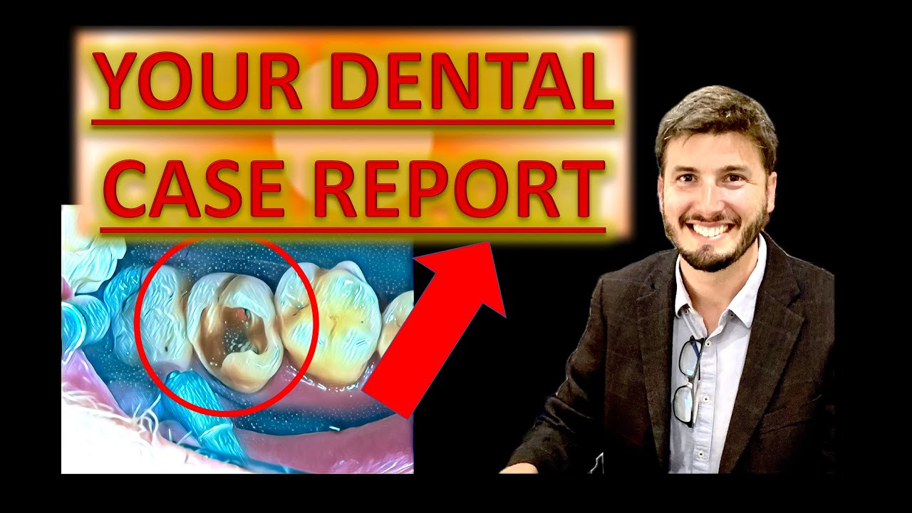 How to Publish Your Own CASE REPORT in DENTISTRY!! (Tutorial ...