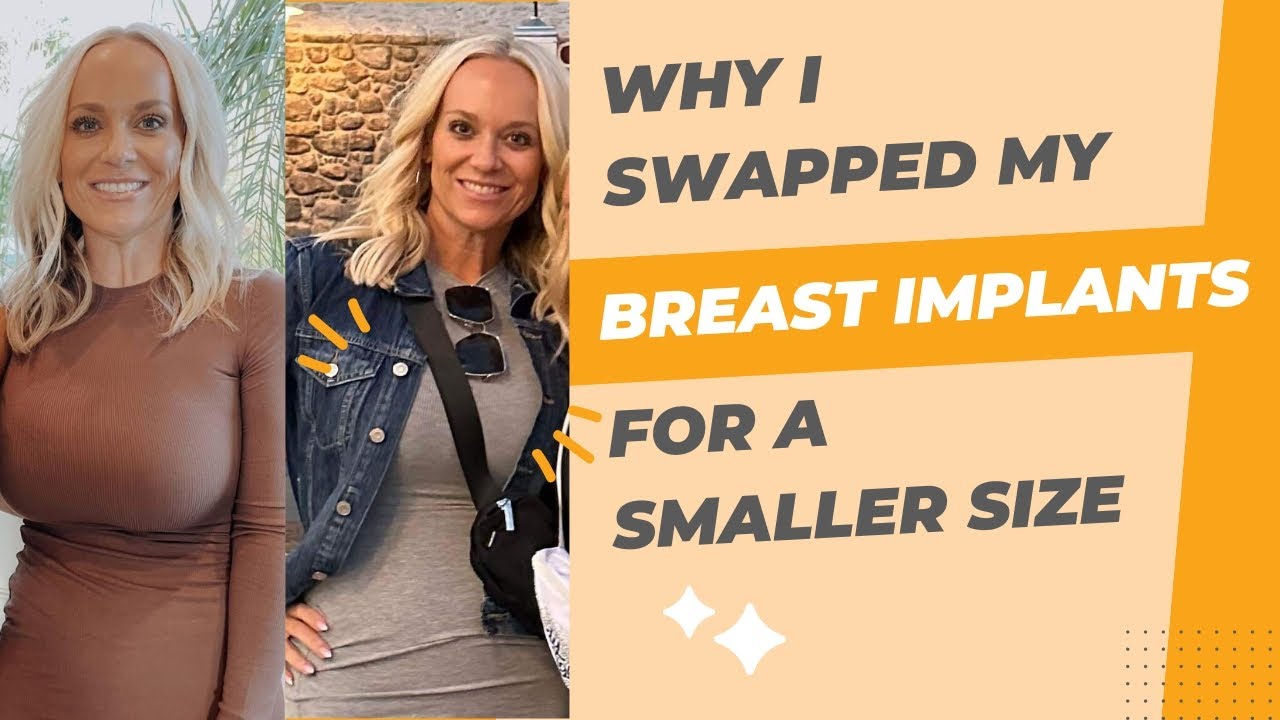 Patient Jaime: Why I Decided To Replace (Not Remove) My Breast Implants ...