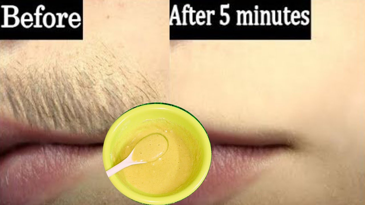 Facial hair removal cream at home | Facial hair removal mask | Instant ...