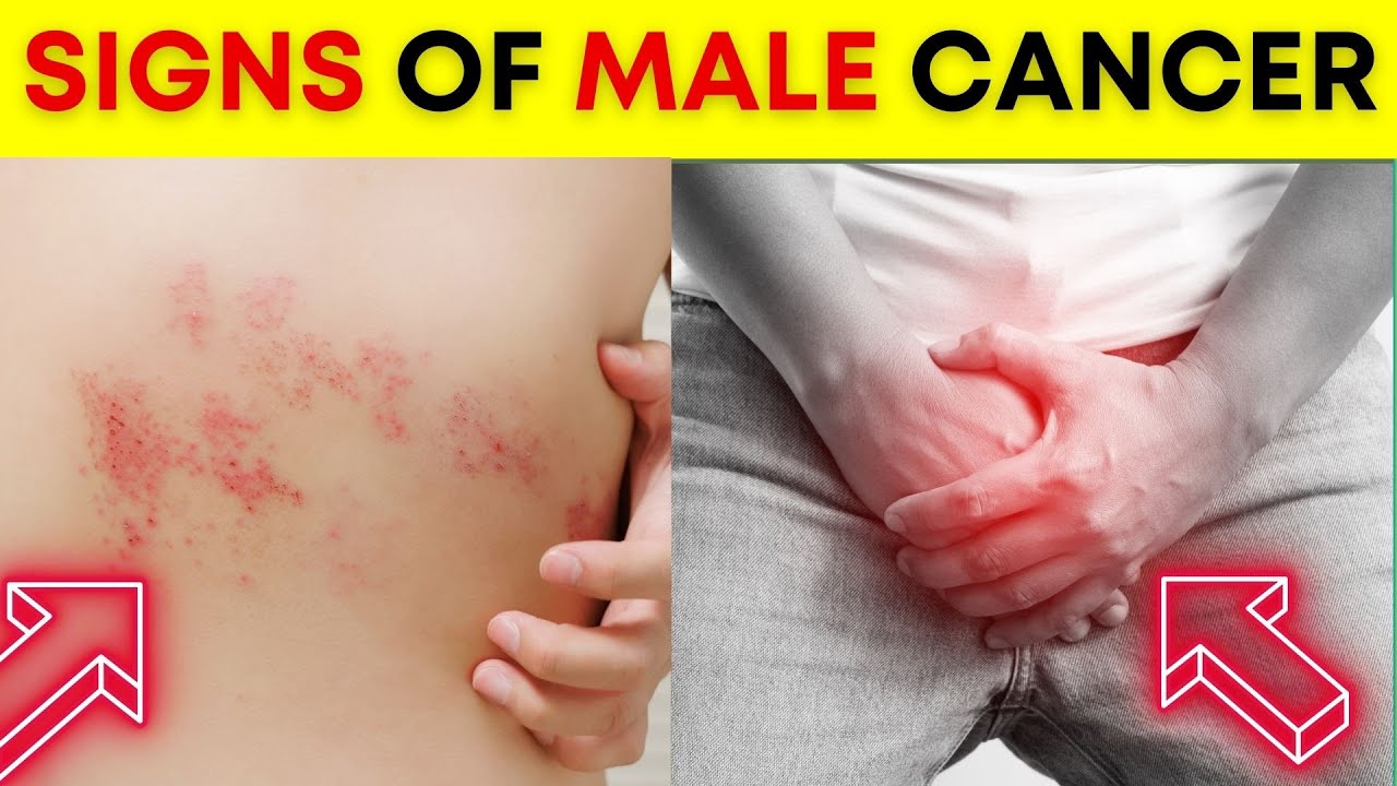 Male Cancer Signs The Top 11 Signs Of Cancer In Men You Should Never Ignore Youtube