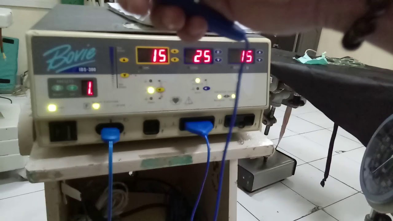 ESU machine calibration. - YouTube