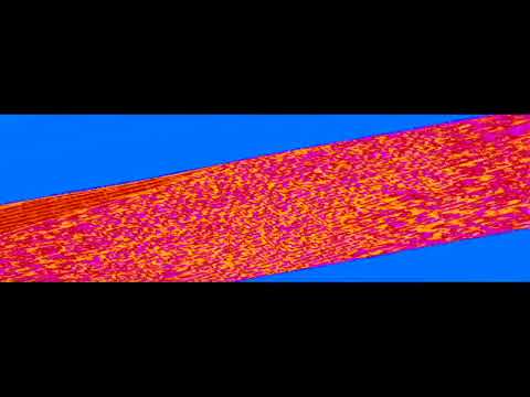 XS AMAZING EAR RAPING CONTEST Rounds - YouTube