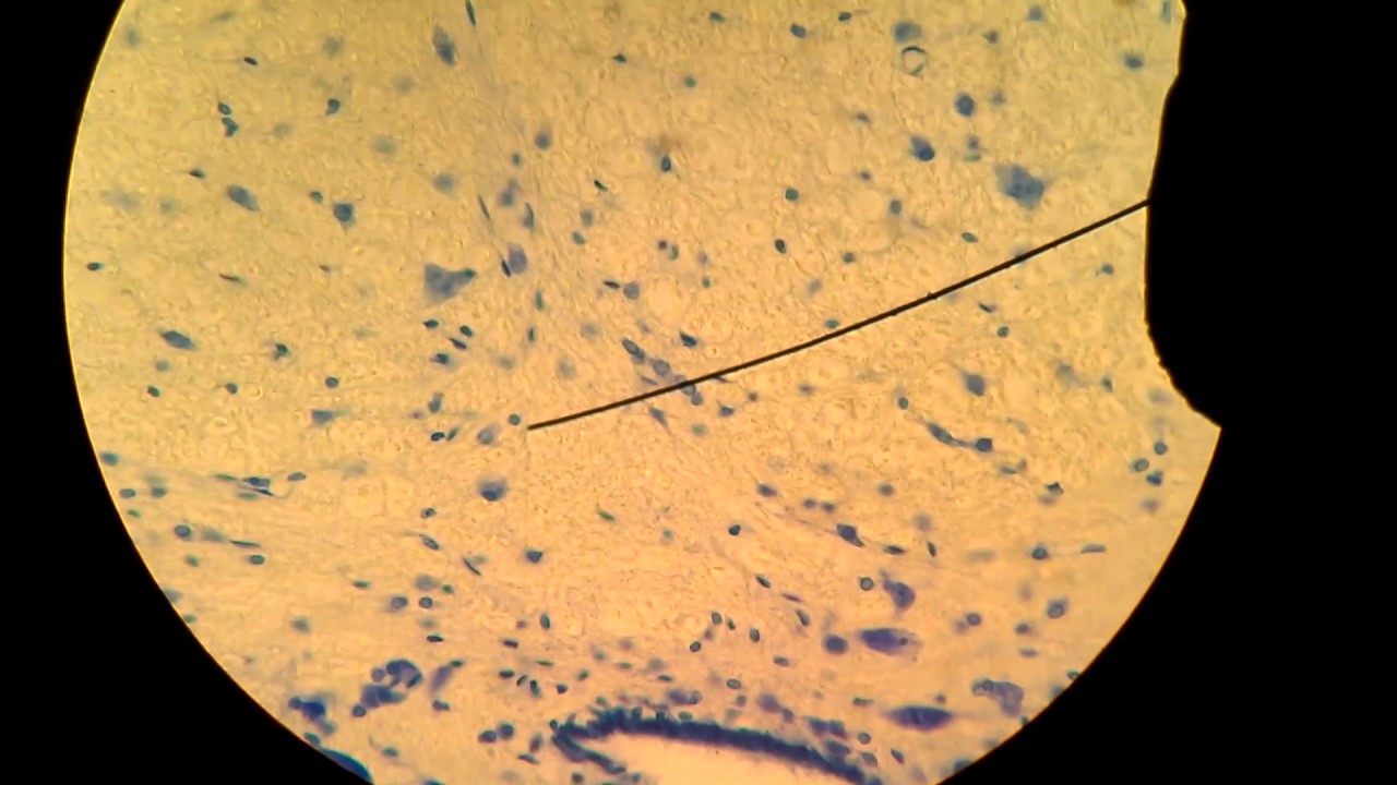 Tigroid (Nissl bodies). Тигроид (тельца Ниссля) - YouTube