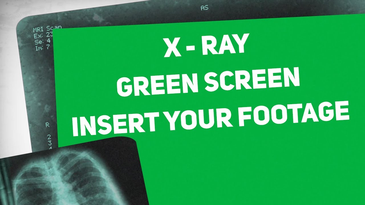 X-Ray Medical Green Screen | Graphics & Animation - YouTube