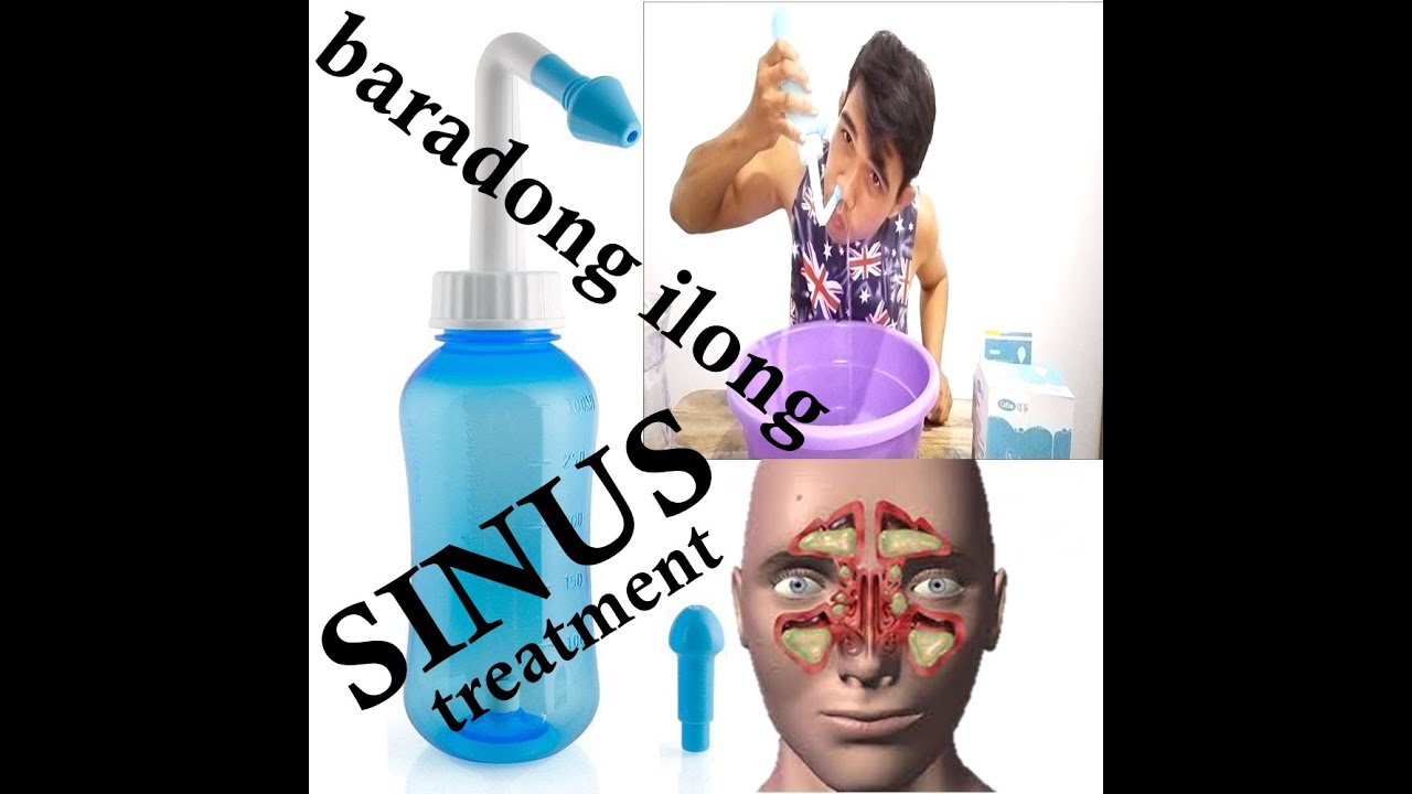 BARADONG ILONG/SINUS RINSE WITH SALINE TREATMENT SIPMLE AND EFFECTIVE ...