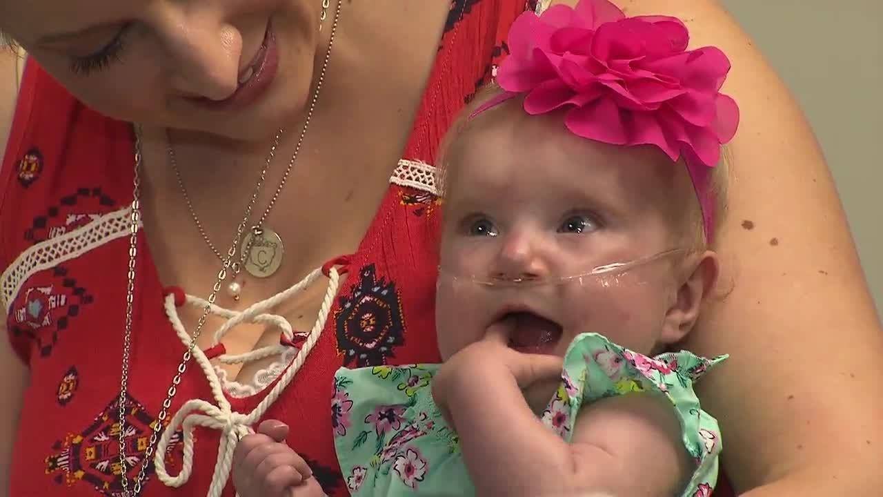 Baby girl undergoes life-saving surgery at Nicklaus Children's Hospital ...