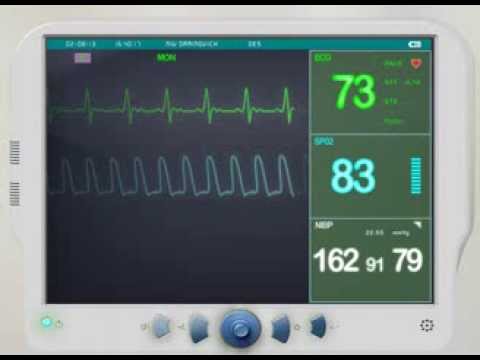 EKG/ECG Monitor animation Lop - YouTube