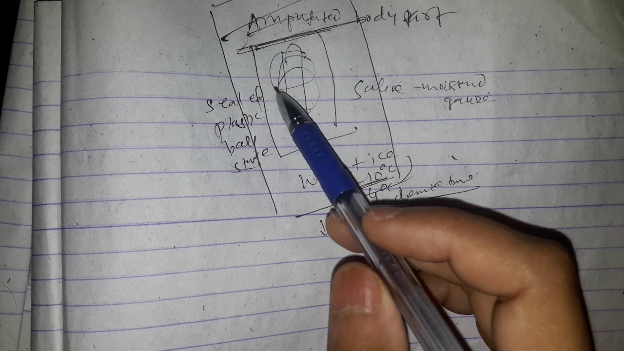 How to transport amputated body part - YouTube