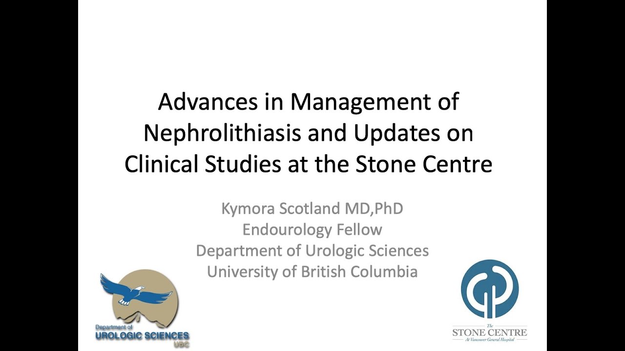 Recent Advances in Nephrolithiasis Management: an Update on Clinical ...