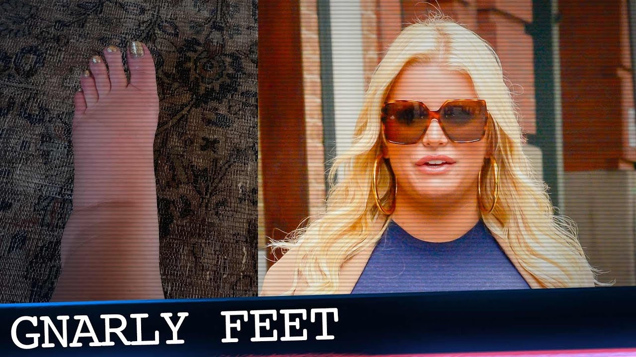Pregnant Jessica Simpson Needs Help for Her Gnarly Swollen Feet - YouTube